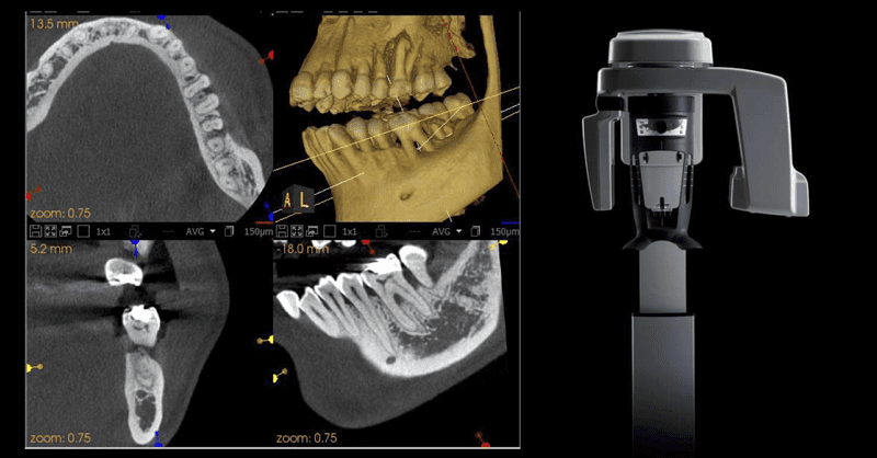 Periodontist in El Cajon, CA | Dr. Ali Haeri D.M.D, M.H.S